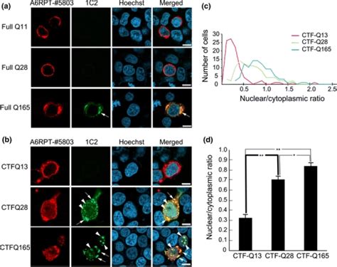Rctf With Expanded Polyq Forms Visible Aggregates With Increased Download Scientific Diagram
