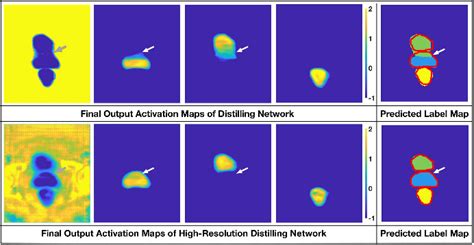 Figure 5 From High Resolution Encoderdecoder Networks For Low Contrast