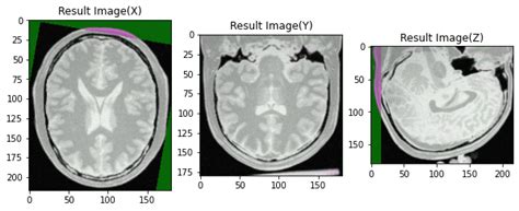 Python Itk 3d 剛性影像對準 Rigid Registration 置中初始化教學與範例 Office 指南