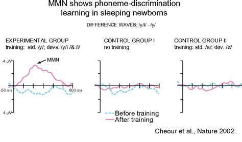 Figure 1 From The Mismatch Negativity Mmn In Basic Research Of Central Auditory Processing A