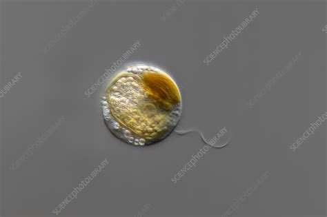 Coccolithophoride Algae Light Micrograph Stock Image C057 4900 Science Photo Library