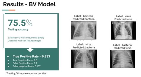 GitHub Yqy Machine Learning Pneumonia Classifier