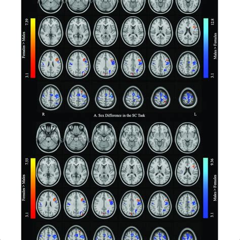 Sex Differences In Each Language Task A Sex Difference In The Download Scientific Diagram
