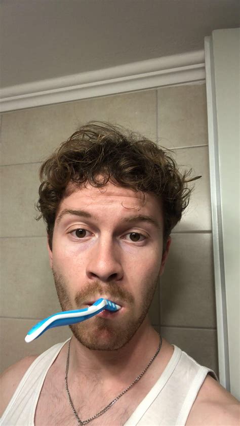 Finasteride 4 Months 22n Does It Cause Diffuse Thinning During