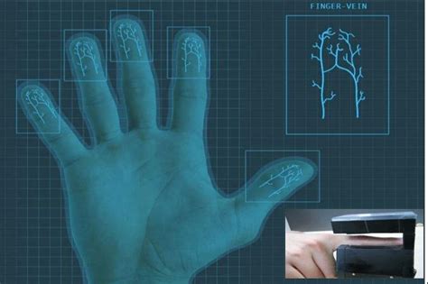finger vein recognition patterns download scientific diagram