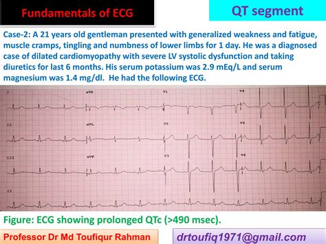 Approach To A Patient With Qtc Interval Abnormality In Ecg Ppsx Approach To A Patient With Qtc Interval Abnormality In Ecg Ppsx