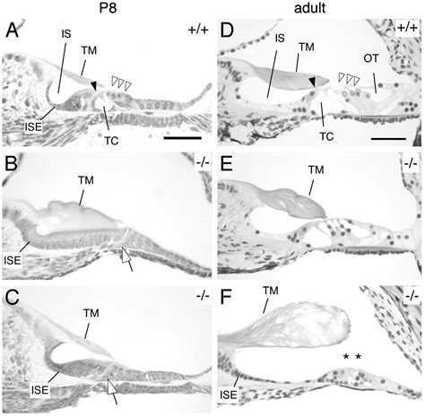 Hearing Loss And Retarded Cochlear Development In Mice Lacking Type 2