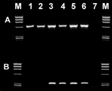 Amplification Products Of The Primary A And Nested B Reaction With