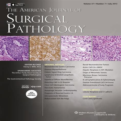 Doxycycline Induced Gastric And Esophageal Mucosal Injuries The American Journal Of