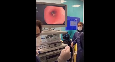 ویدئو خروج پوست تخمه از ریه کودک یک ساله دکتر اردا کیانی