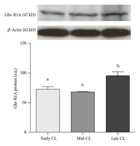 Protein Expression Of Lep A Lepr B Ghr C And Ghr R1a D Download Scientific Diagram