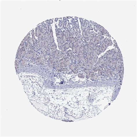 Tissue Expression Of Slc1a2 Staining In Stomach The Human Protein Atlas