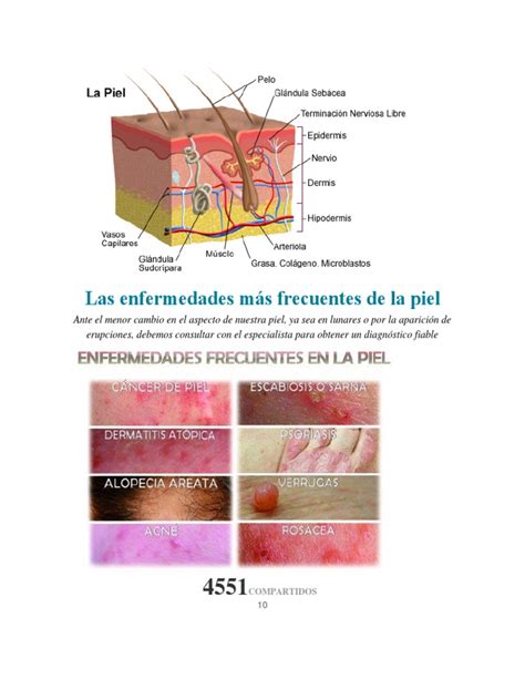 Las Enfermedades Más Frecuentes De La Piel Pdf Piel Epidermis