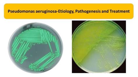Pseudomonas Aeruginosa On Macconkey Agar