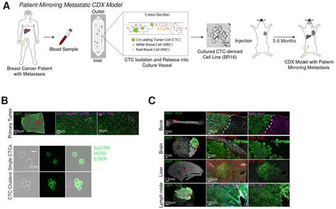 Generation And Characterization Of A Ctc Derived Xenograft Model