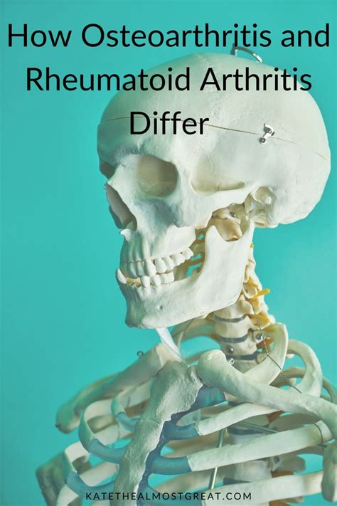 Rheumatoid Arthritis Tips Artofit