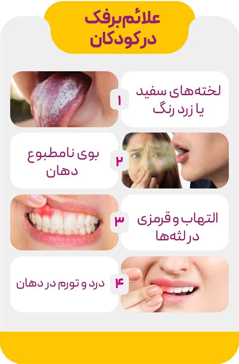 برفک دهان و راه های درمان آن