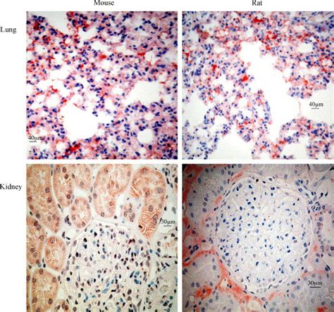 Organ Specific Distribution Of Ace2 Mrna And Correlating Peptidase