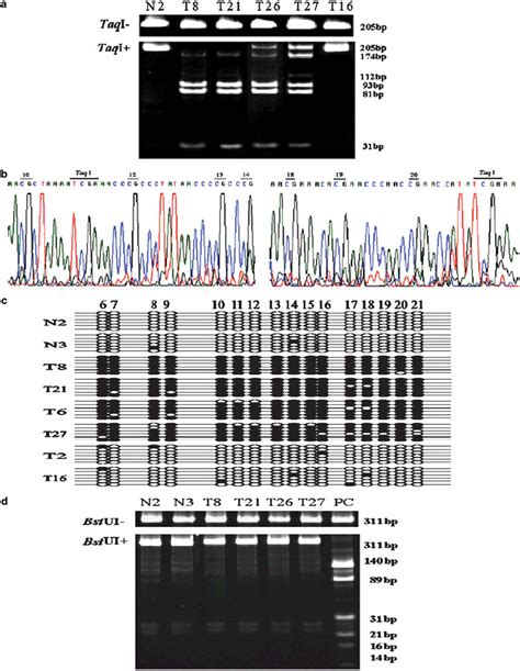 Methylation Analysis Of Rassf1a And Rassf1c Promoter By Cobra And