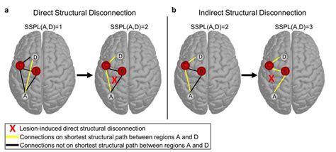 Defining Direct And Indirect Structural Disconnections A The Brain Download Scientific