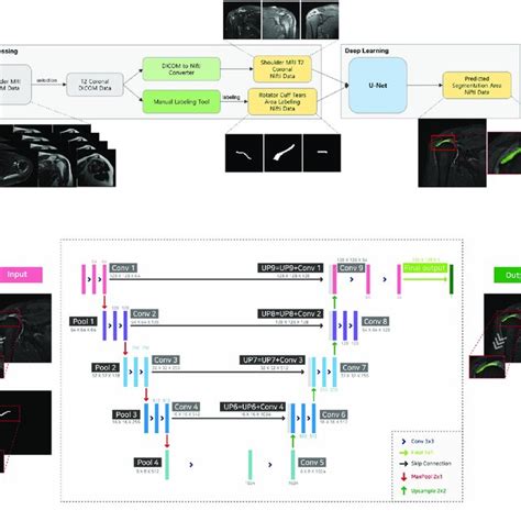 entire architecture of 3d u net for the rct segmentation a flowchart