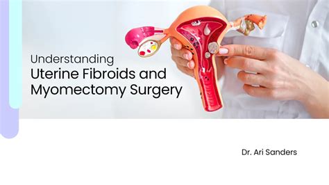 Understanding Uterine Fibroids And Myomectomy Surgery