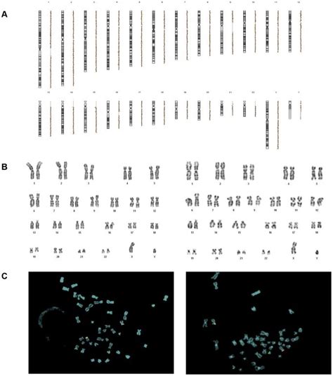 A Array Cgh Profiles Of All Mscs At P4 Isolated At Diagnosis D 0 And Download Scientific