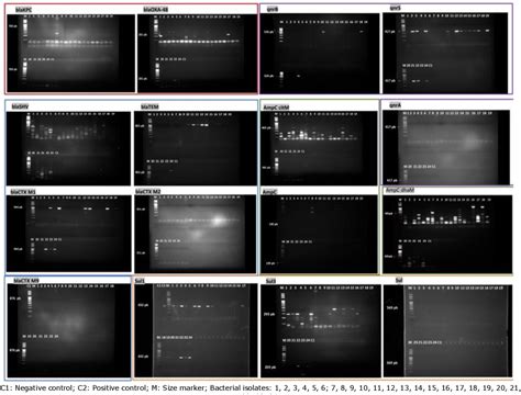 Figure 2 From Molecular Detection Of Antimicrobial Resistance Genes In Multidrug Resistant Gram