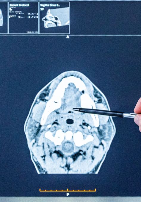 Head And Neck Cancer Surgeon Sydney Dr Julia Crawford
