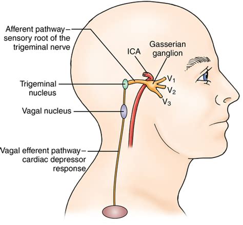 Oculocardiac Reflex Clinical Gateclinical Gate