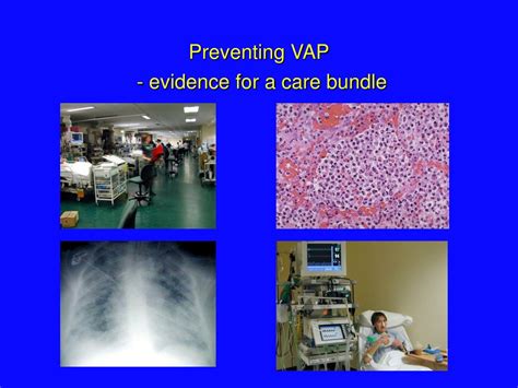 Ppt Preventing Vap Evidence For A Care Bundle Powerpoint Presentation Id 187377