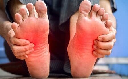 Why Are My Feet Red Symptoms Causes And Treatment For Red Feet