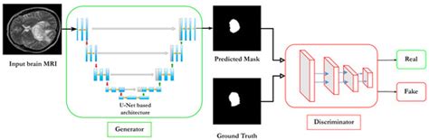 u net based models towards optimal mr brain image segmentation