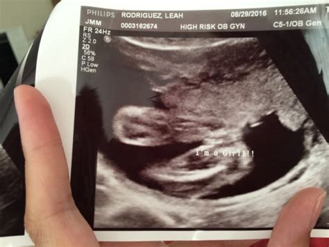 23 Weeks Ultrasound