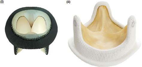 I Pericarbon More Surgical Bioprosthetic Valve Ii Hancock Ii I Pericarbon More Surgical Bioprosthetic Valve Ii Hancock Ii