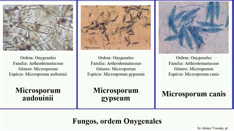 Microsporum Audouinii