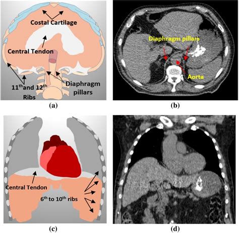 Anatomy Based Algorithm For Automatic Segmentation Of Human Diaphragm