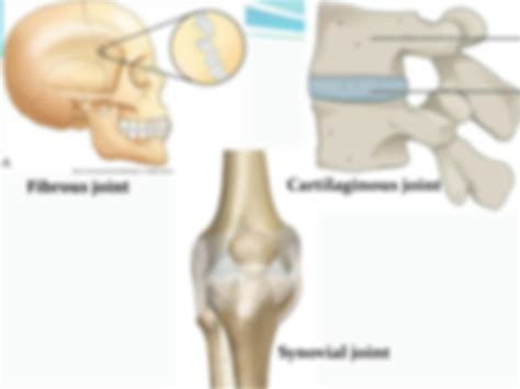 Solution Basic Anatomy Classification Of Joints Studypool
