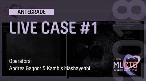 Live Case 1 Mlcto Academy
