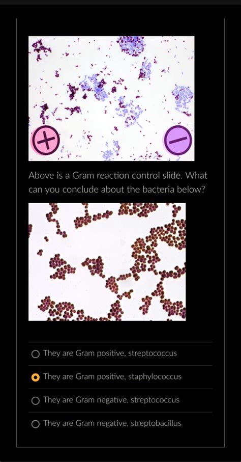Above Is A Gram Reaction Control Slide What Can You Conclude About The Bacteria Below They Are