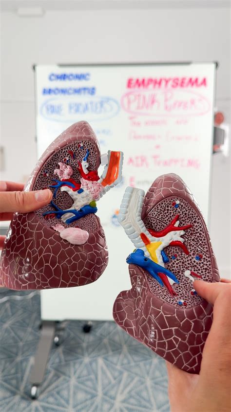 Emphysema Vs Chronic Bronchitis