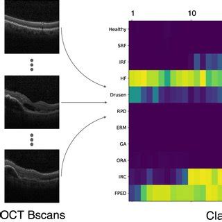 Evaluation Of An OCT Volume Scan Left Using Our Proposed Automated Download Scientific