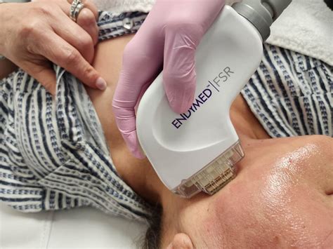 What Is Rf Exploring The Benefits And Science Behind Radiofrequency Therapy Iv Therapy