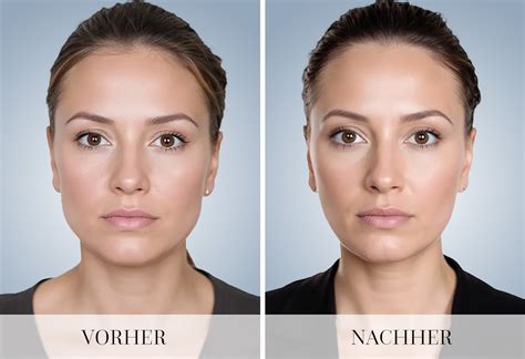 Masseter Botox Vorteile Ablauf Und Kosten Ihr Leitfaden
