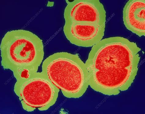 Mrsa Resistant Staphylococcus Bacteria Stock Image B234 0067 Science Photo Library