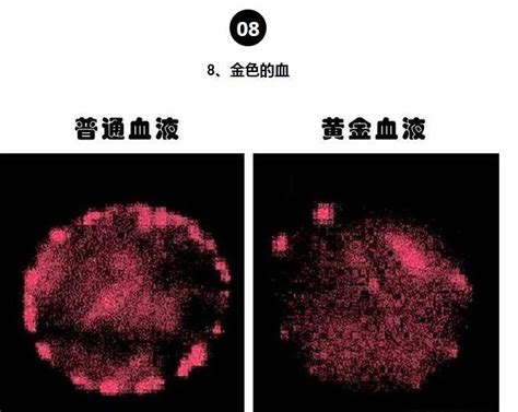 罕见的身体特征:只有少数人身上才拥有的10个罕见的特征 罕见的身体特征:只有少数人身上才拥有的10个罕见的特征