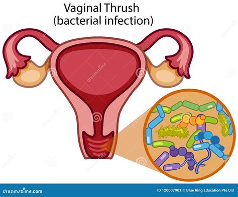Vaginal Cartoons Illustrations Vector Stock Images Pictures To Download From