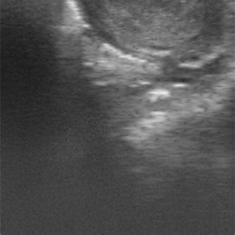 Pdf Relationship Between Estrus Endometrial Edema And Progesterone
