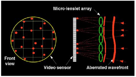advanced optical wavefront technologies to improve patient quality of