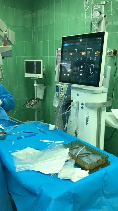 Seyed Ebrahim Torabi On Linkedin A Short Video Of Sophi Phaco Machine